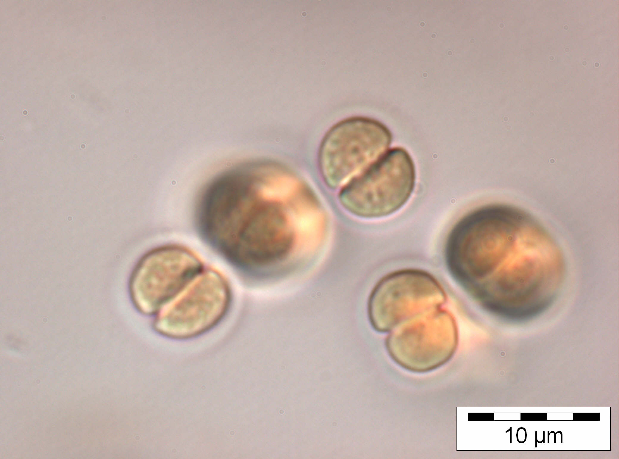 Chroococcus limneticus