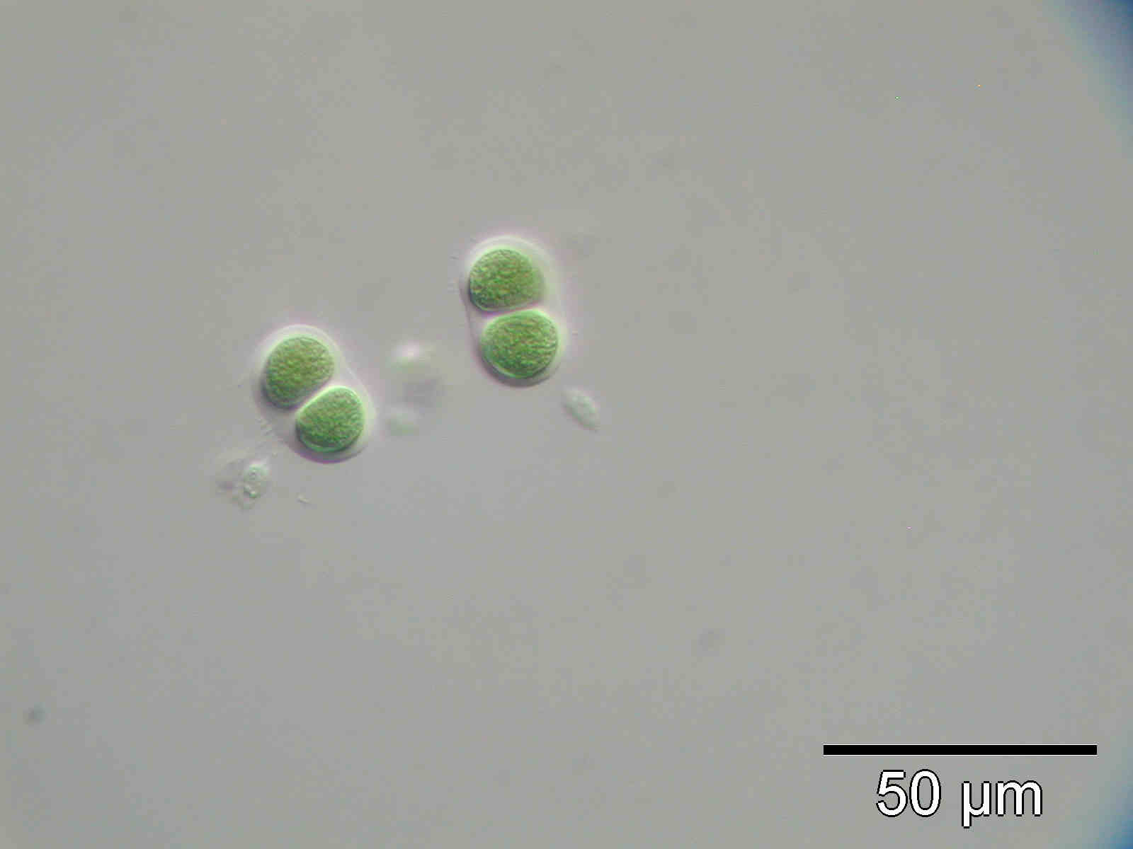 Chroococcus turgidus